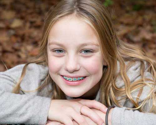 Braces for Children – What You Need to Know